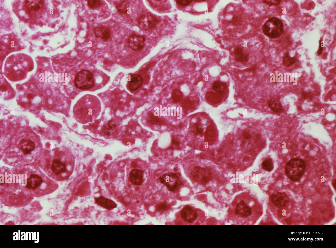 Human Liver Cells Under Microscope