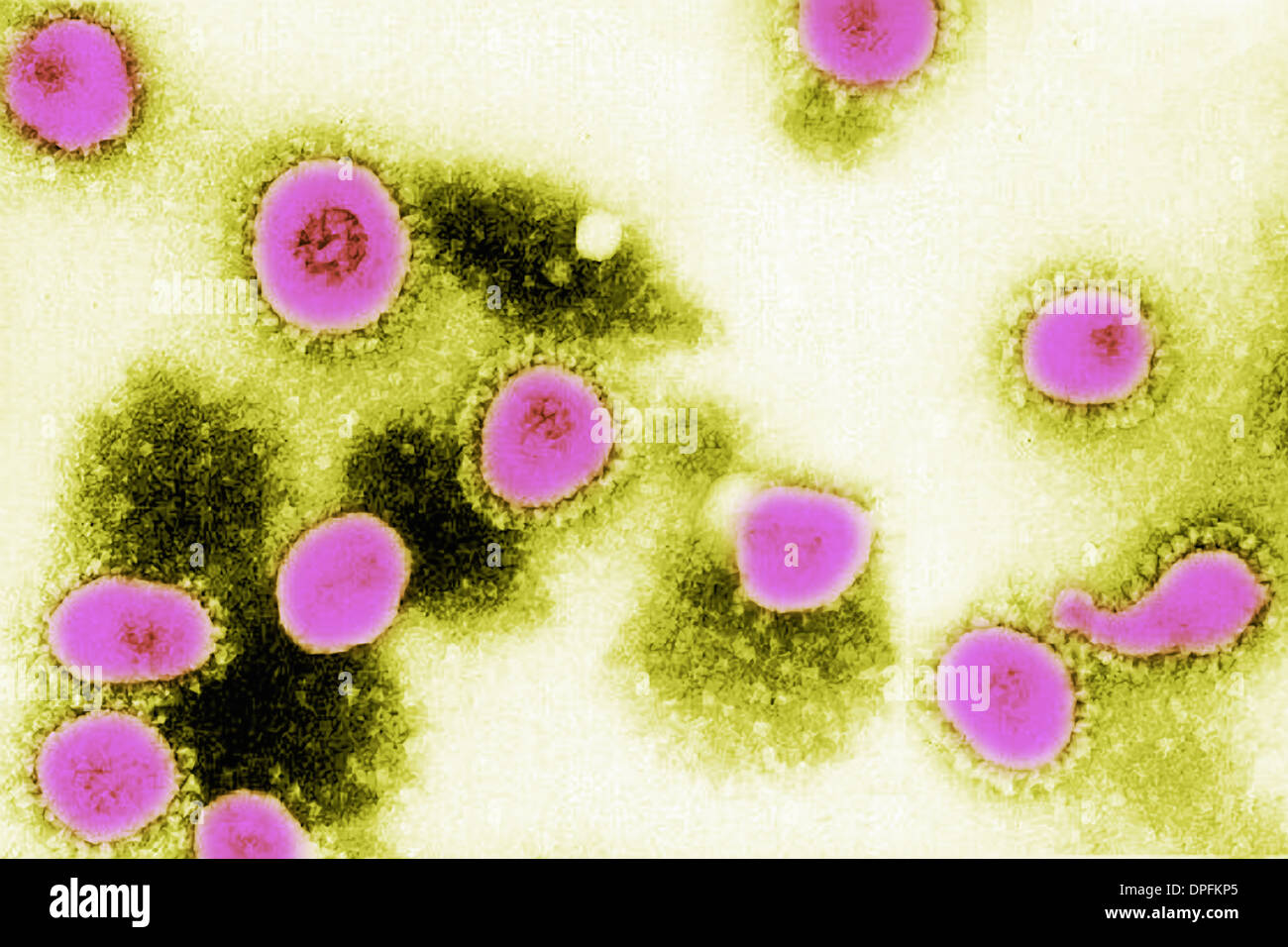 TEM showing coronavirus OC43 virions Stock Photo - Alamy