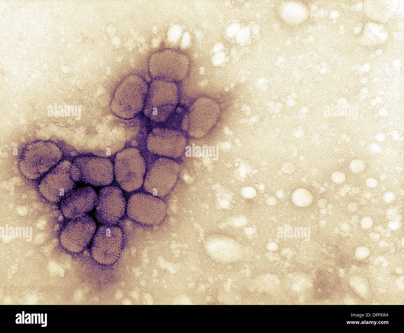 Smallpox hi-res stock photography and images - Alamy