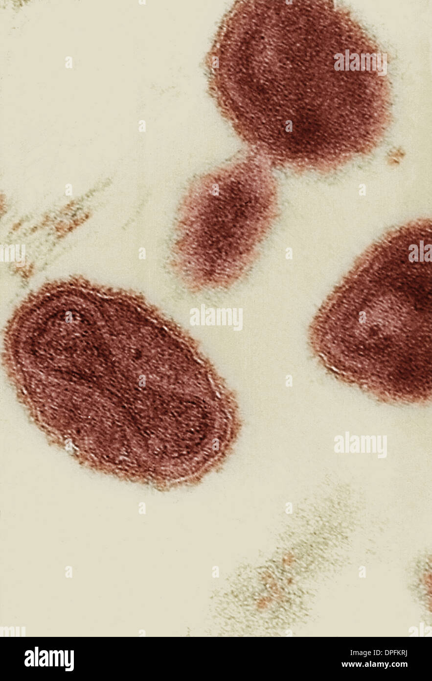 EM image variola (smallpox) viruses Stock Photo - Alamy
