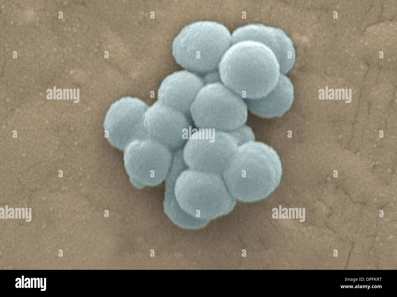SEM of Group C Streptococcus bacteria Stock Photo - Alamy
