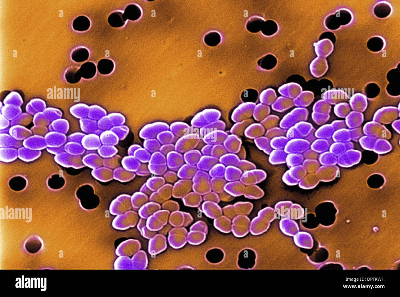 Vancomycin Resistant Enterococcus Infection