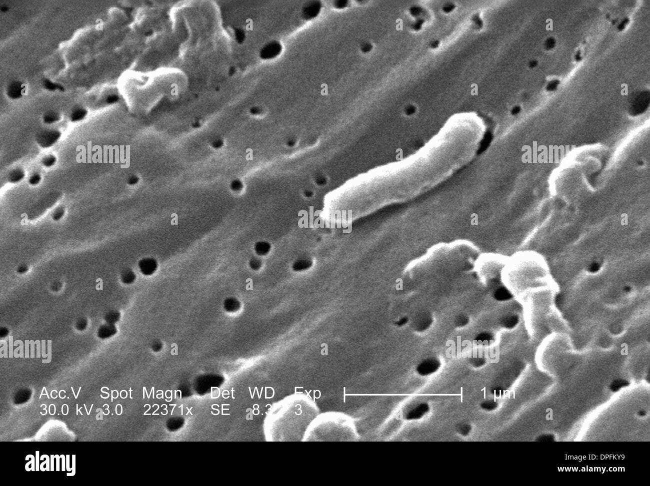 Coloured scanning electron micrograph Black and White Stock Photos ...