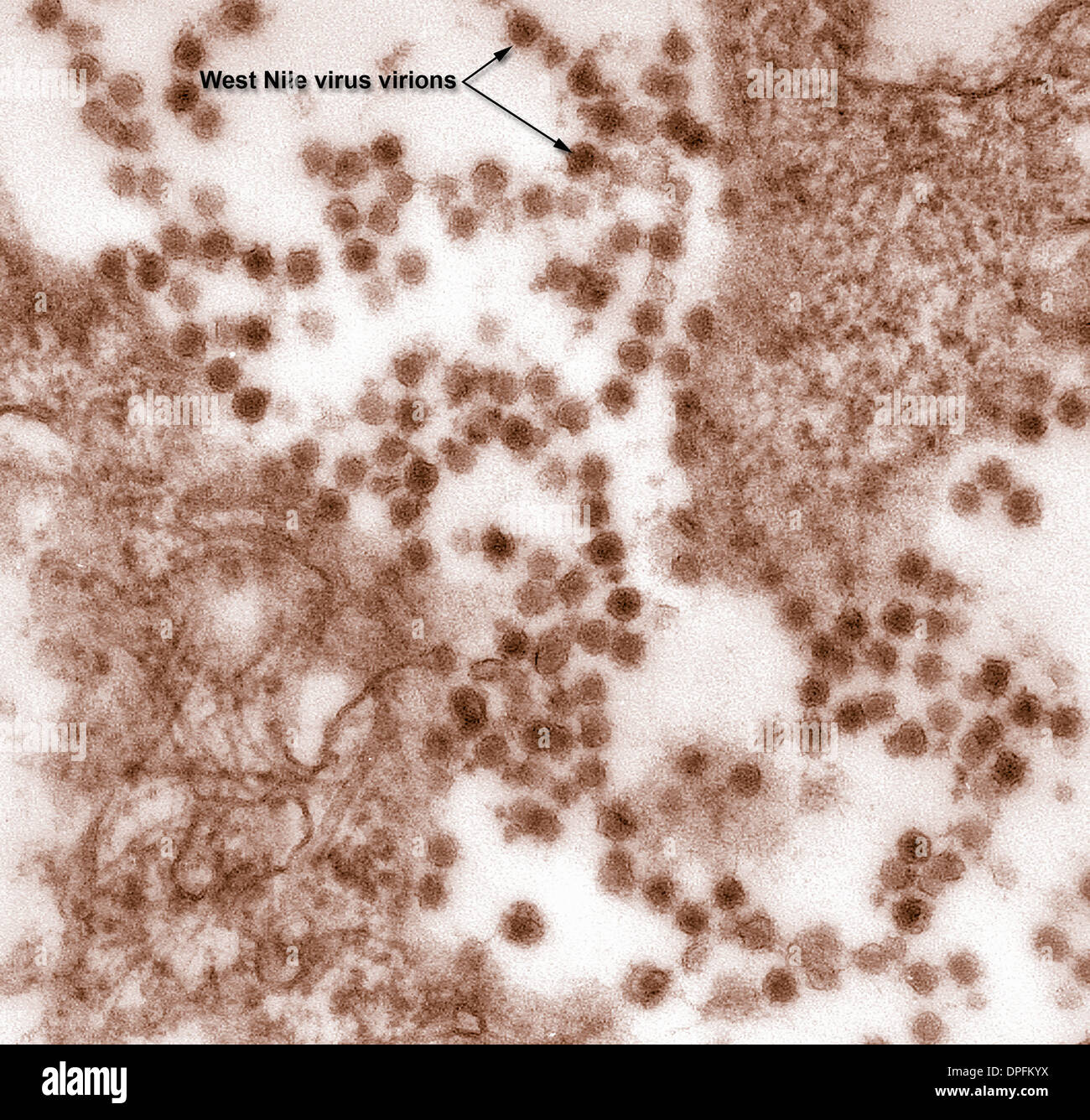 TEM of West Nile virus Stock Photo - Alamy
