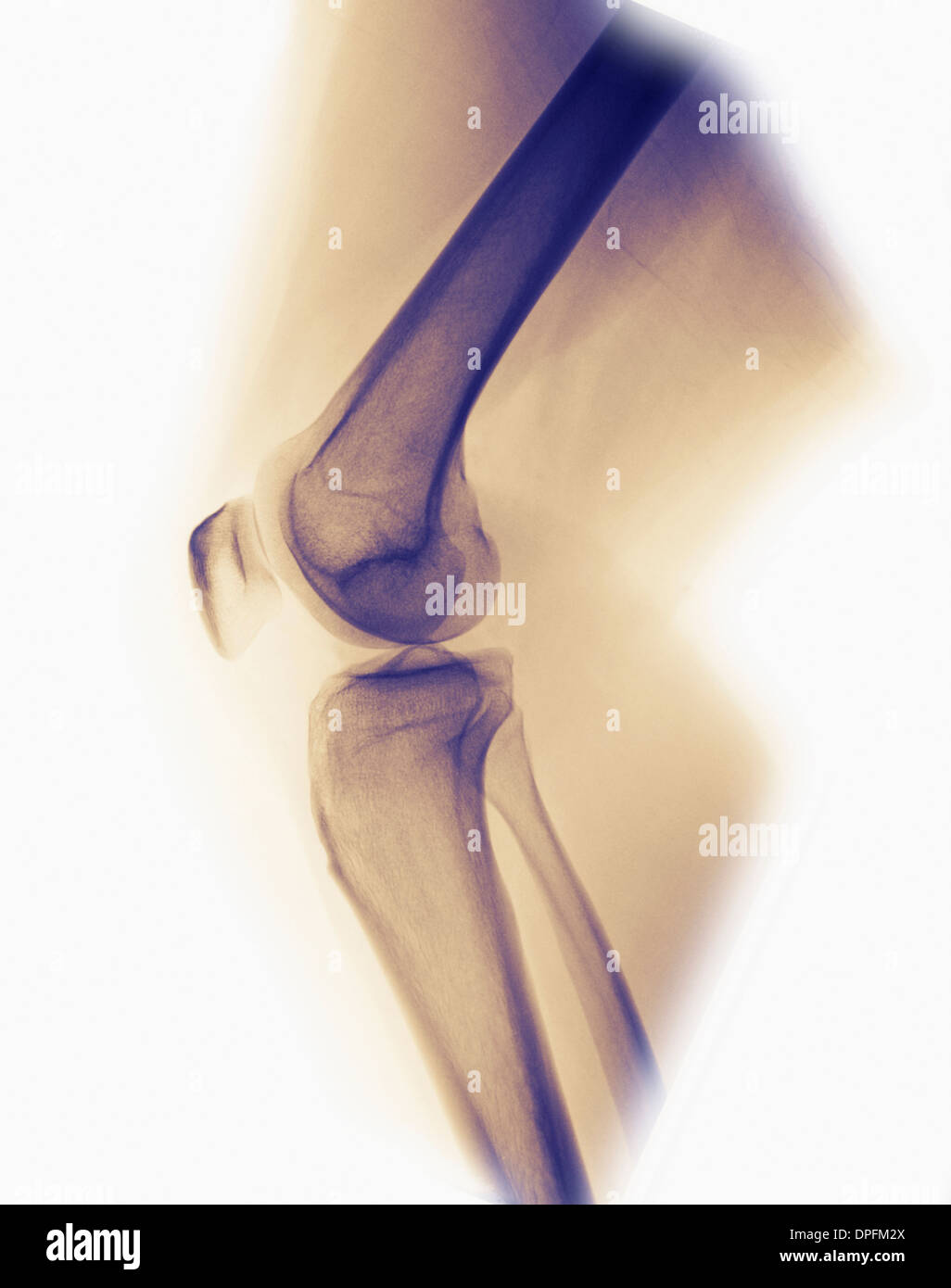 Normal knee x ray hi-res stock photography and images - Alamy