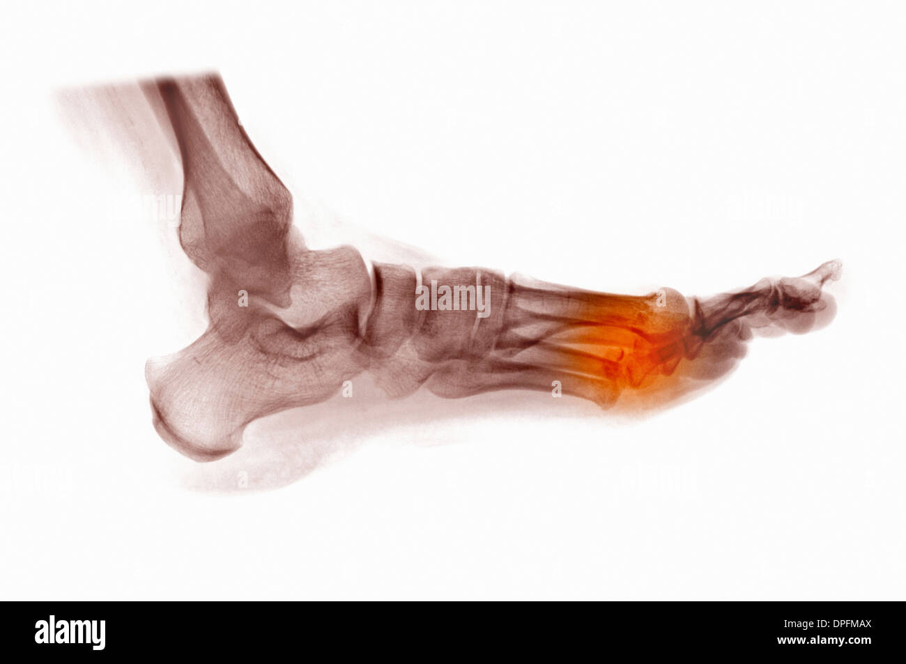 Ray b Cut Out Stock Images & Pictures - Alamy