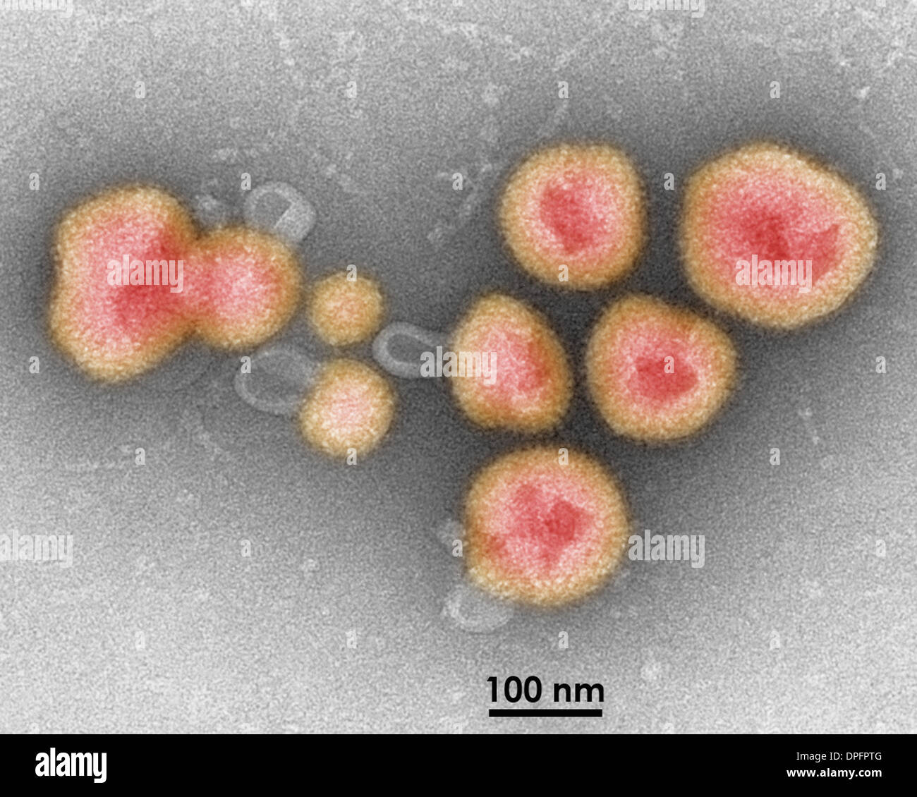 TEM of Arenavirus Stock Photo - Alamy