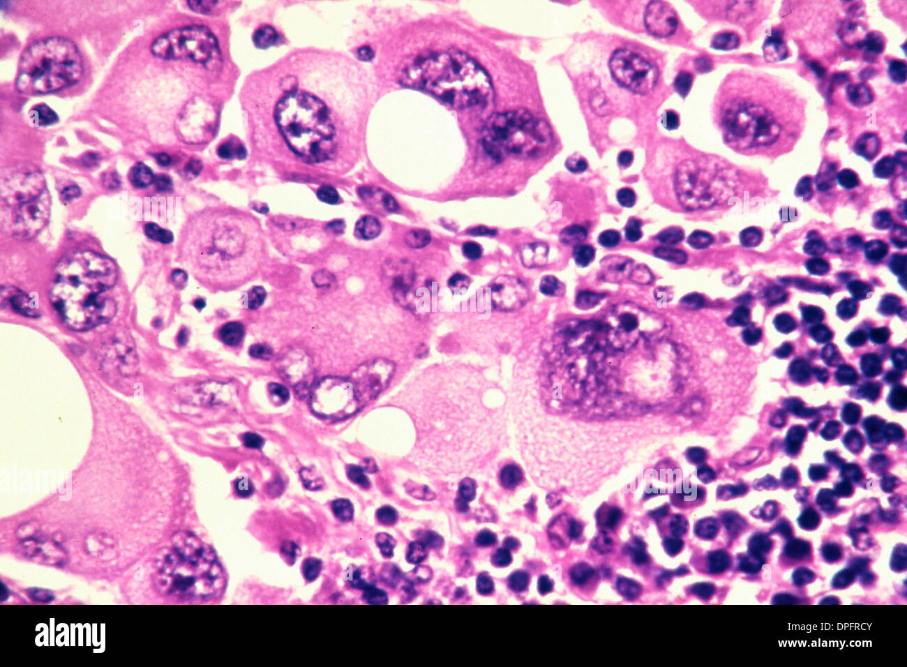 Human skin cells magnified hi-res stock photography and images - Alamy