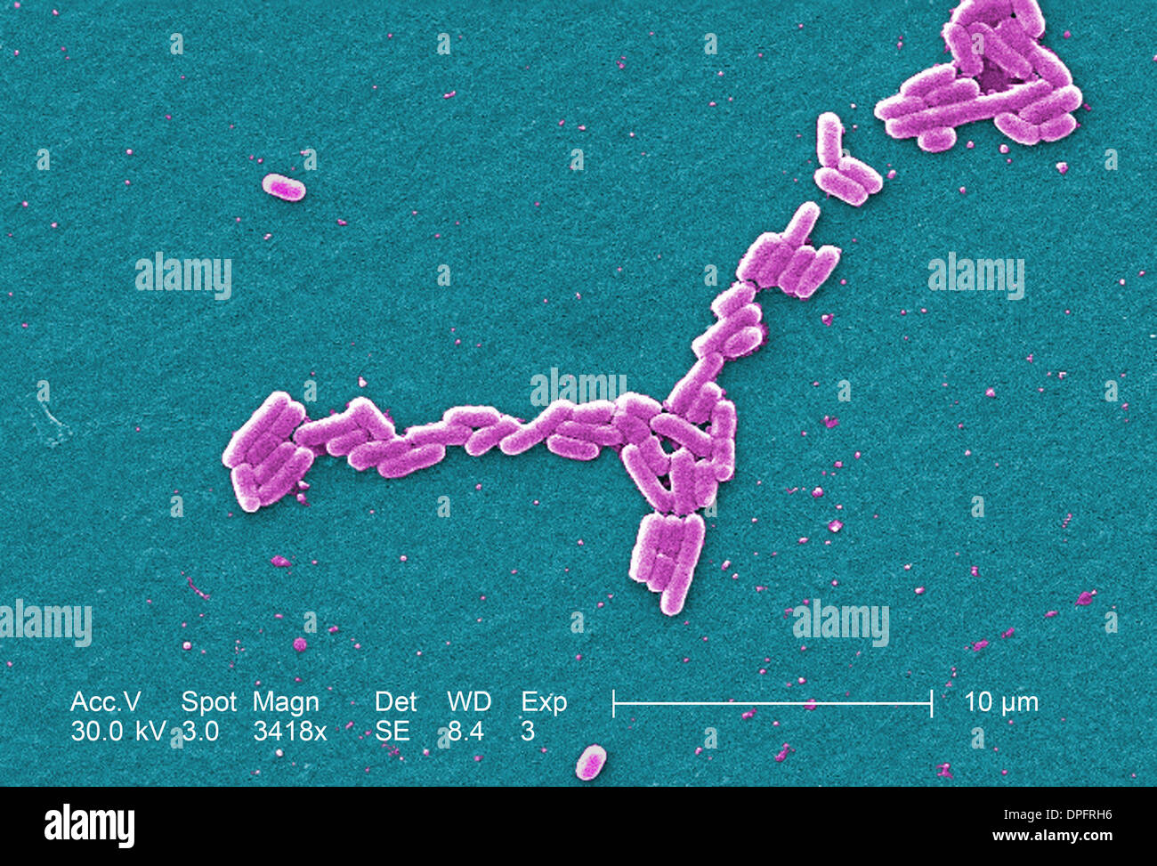 E coli micrograph hi-res stock photography and images - Alamy