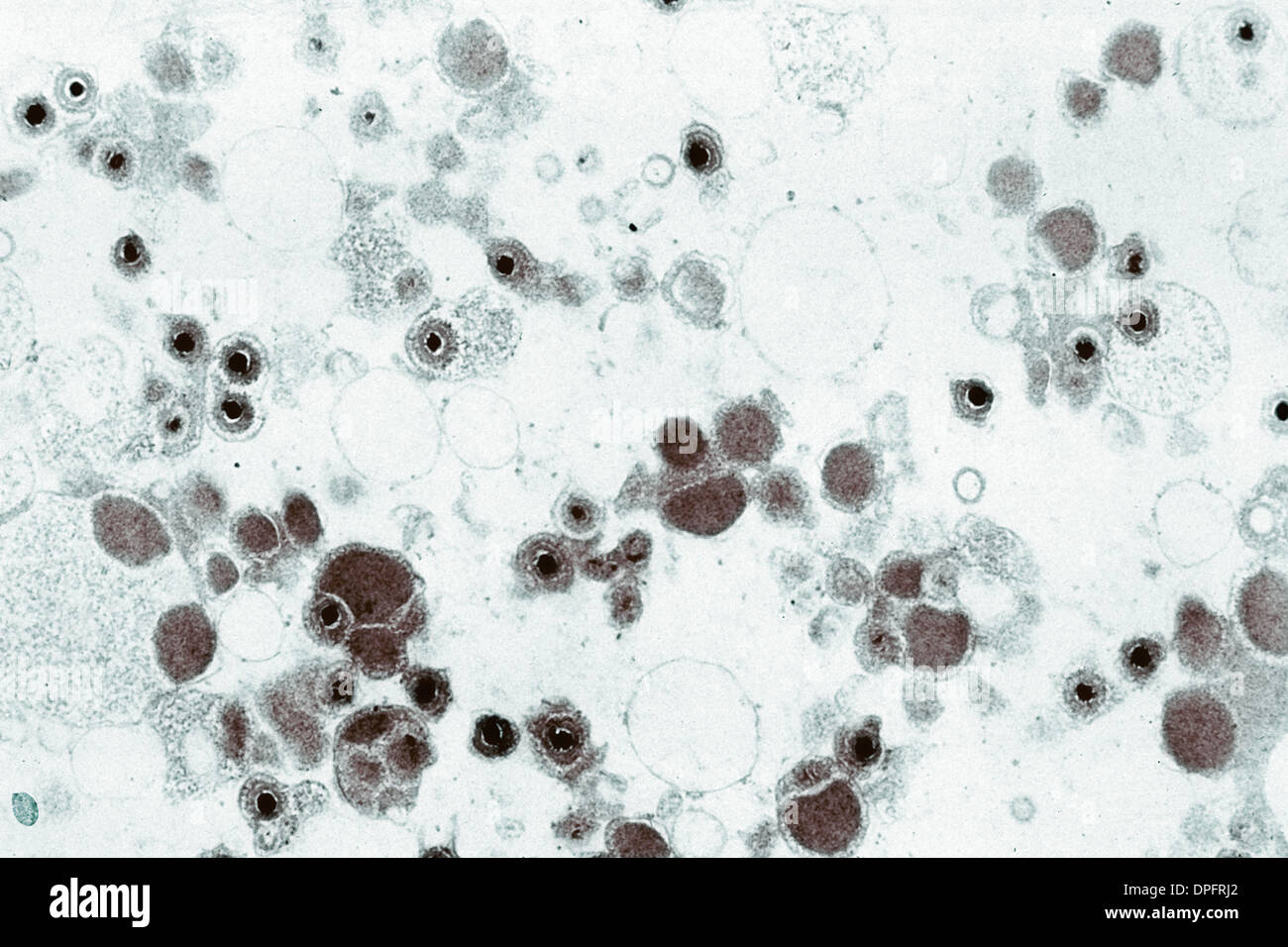 Cytomegalovirus hi-res stock photography and images - Alamy