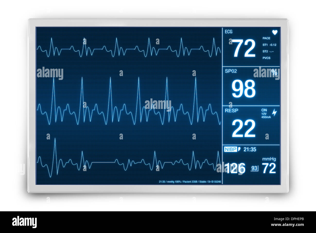 Heart Rate Monitoring Device 3D Render Illustration. Healthcare ...