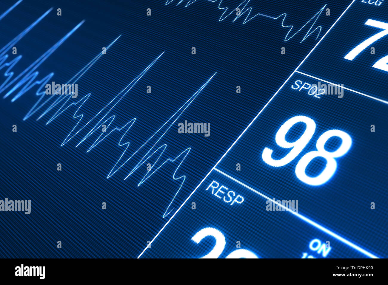 Dead heart monitor hi-res stock photography and images - Alamy