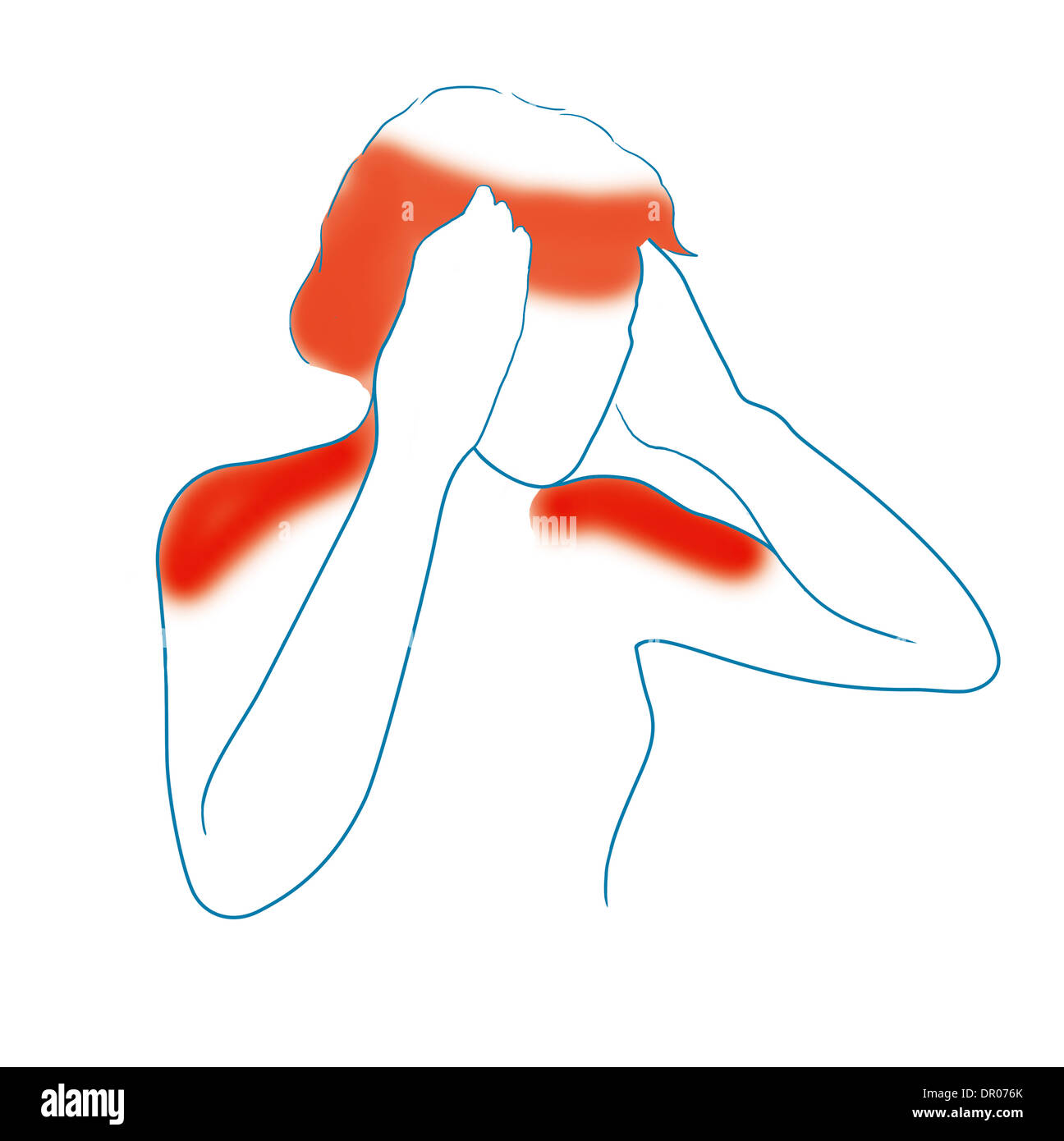 Headache drawing illustration female hi-res stock photography and ...