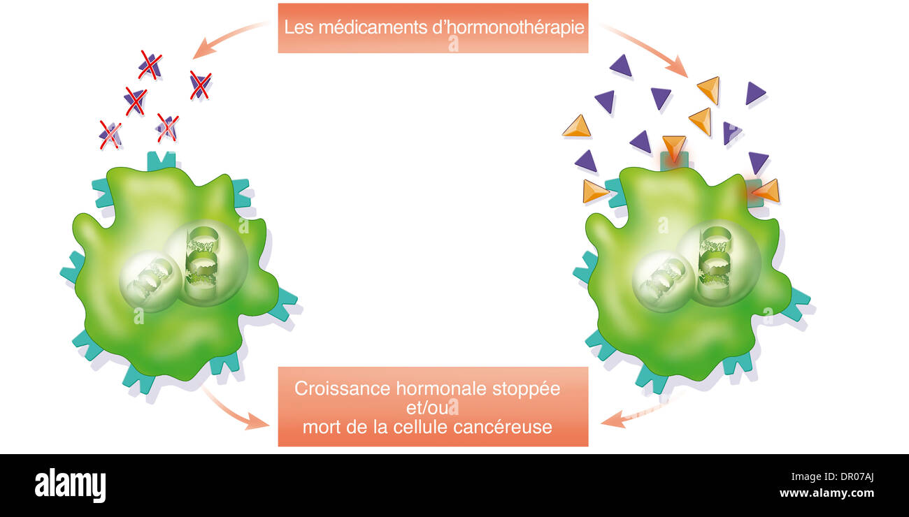 Hormone dependent tumor hi-res stock photography and images - Alamy