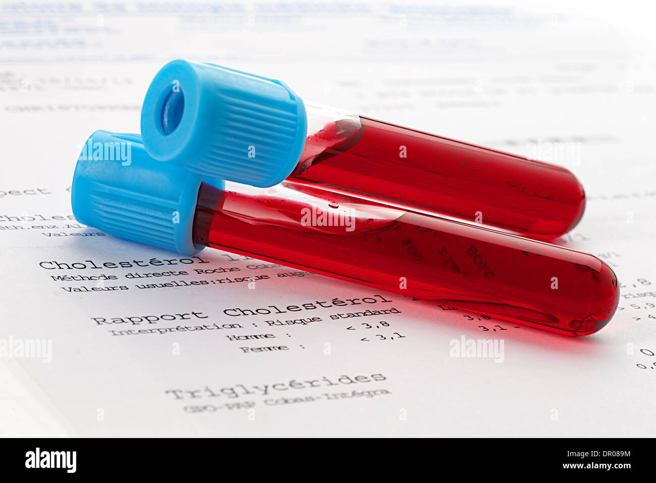 BLOOD ANALYSIS RESULT Stock Photo - Alamy