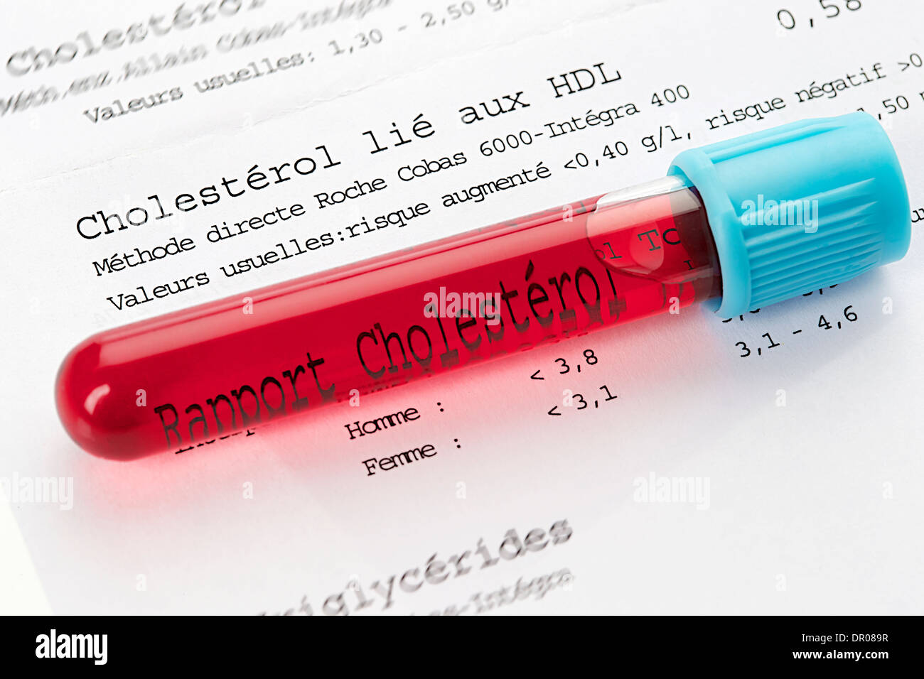 High cholesterol blood test hi-res stock photography and images - Alamy