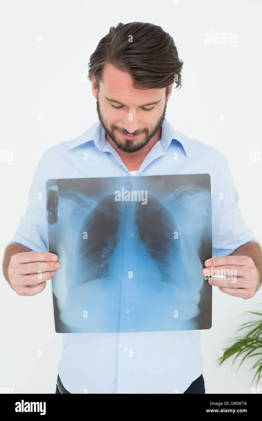 Smiling young man holding lung x-ray Stock Photo - Alamy Smiling young man holding lung x-ray Stock Photo - Alamy