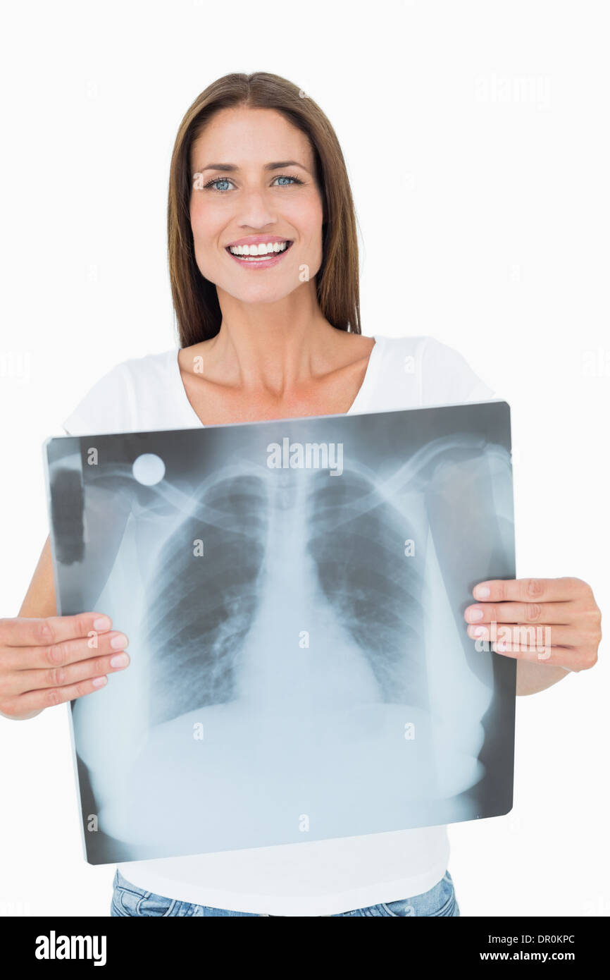 Woman chest x ray hi-res stock photography and images - Alamy