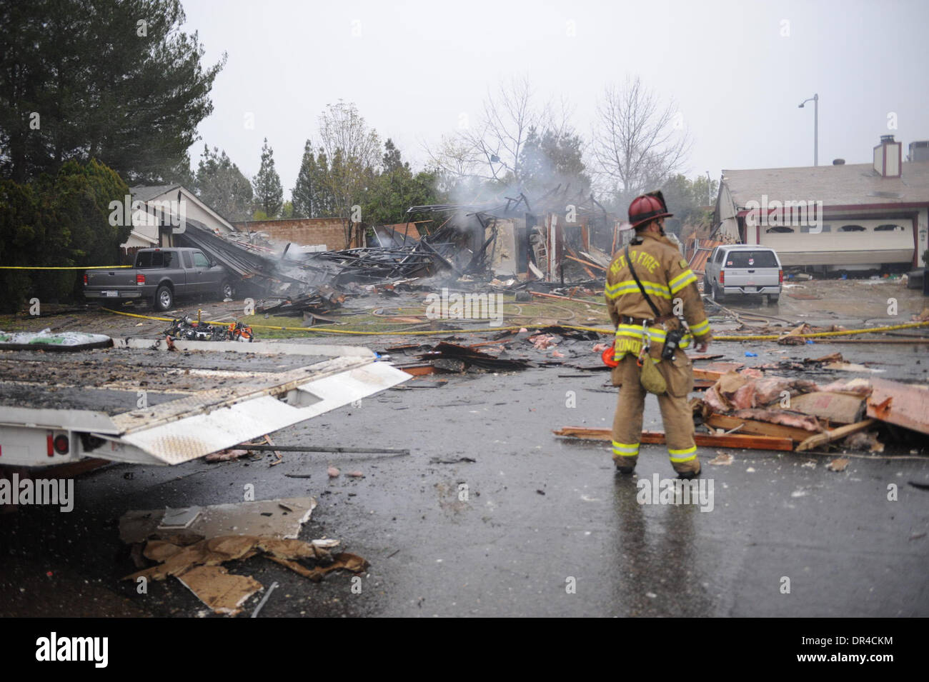 Three degree burns hi-res stock photography and images - Alamy