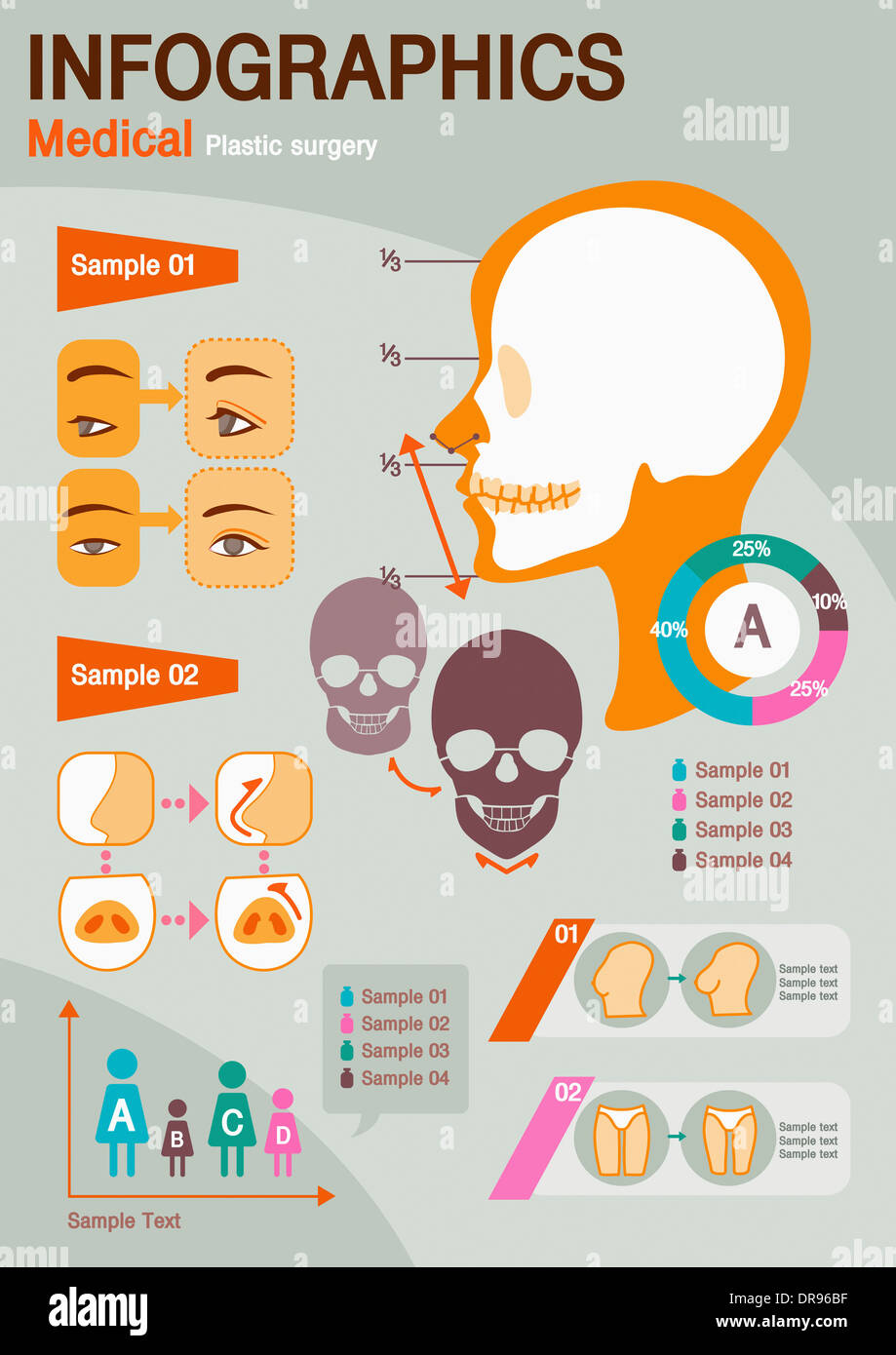 illustration of medical info graphics related to plastic surgery Stock ...