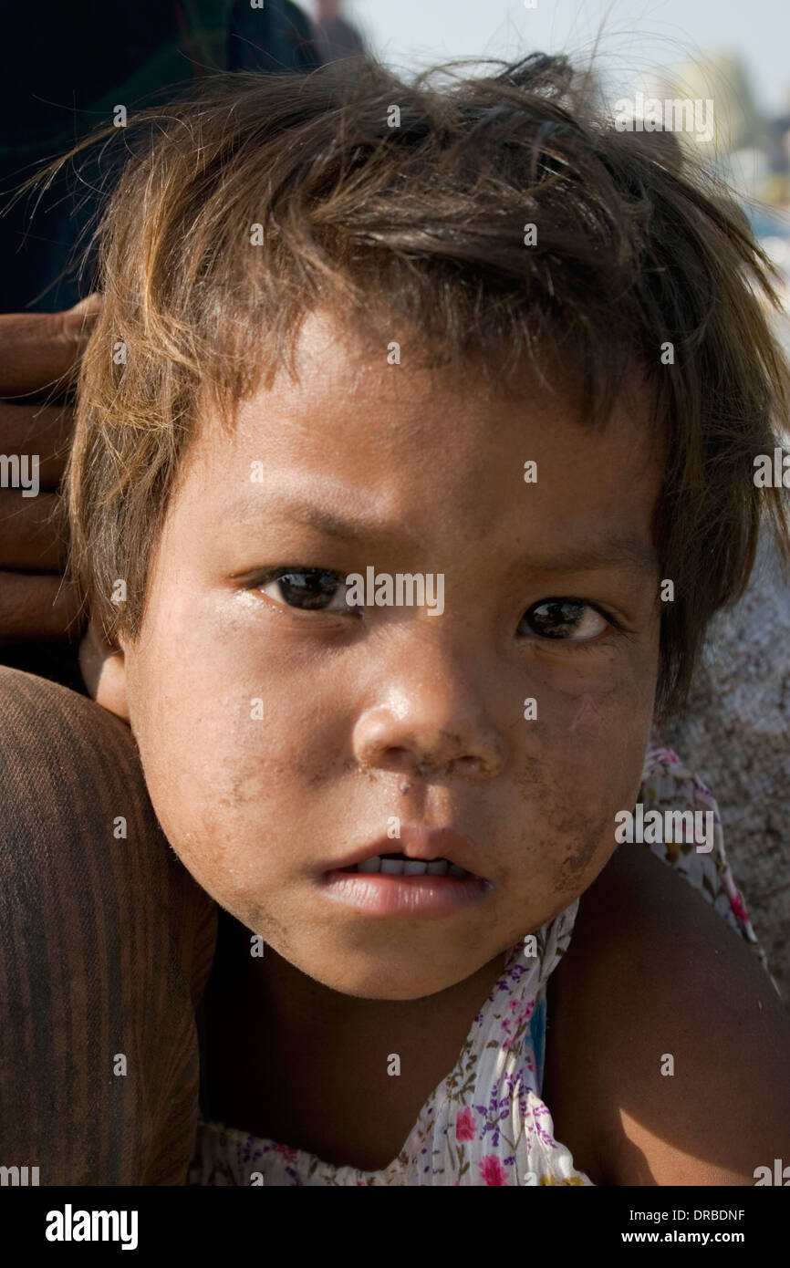 A young child laborer girl with a dirty face is sitting in the toxic ...