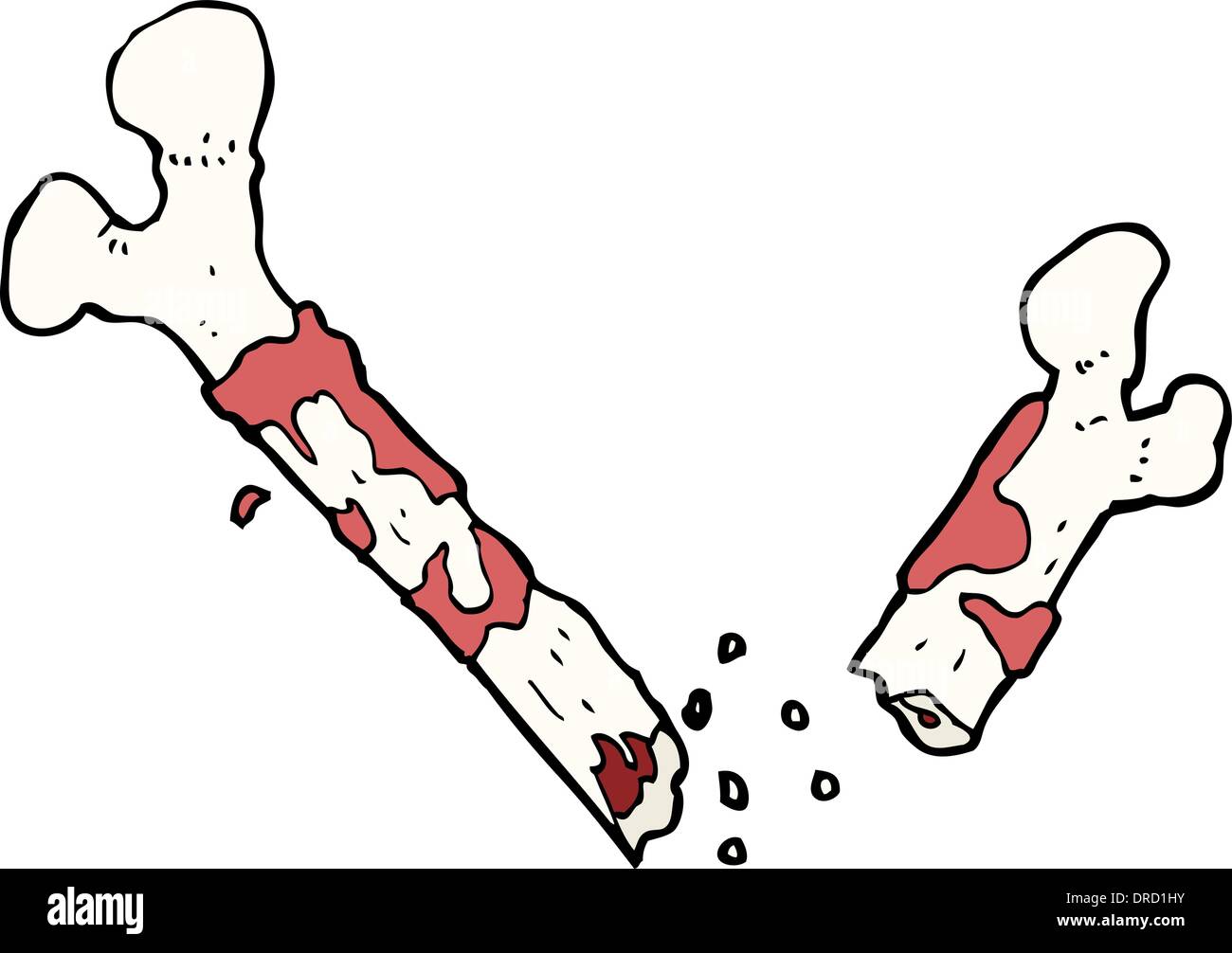 gross broken bone cartoon Stock Vector Image & Art - Alamy