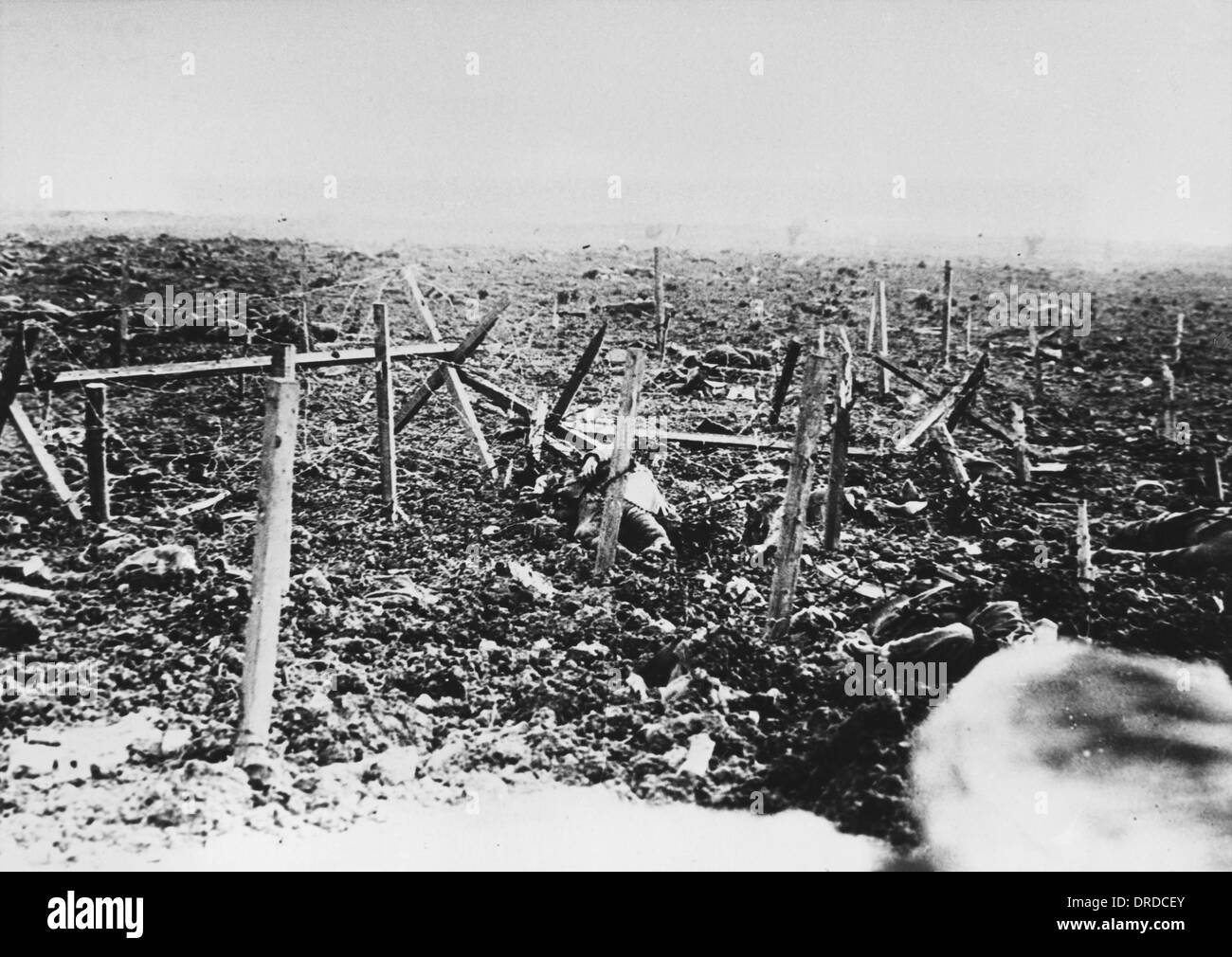 British wounded WWI Stock Photo - Alamy