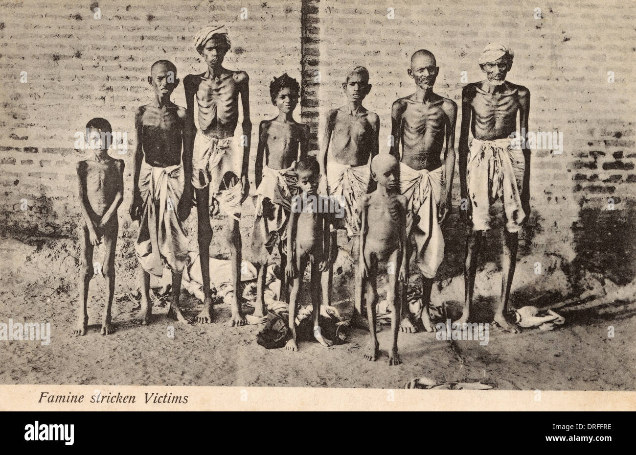 Famine Victims - India Stock Photo - Alamy