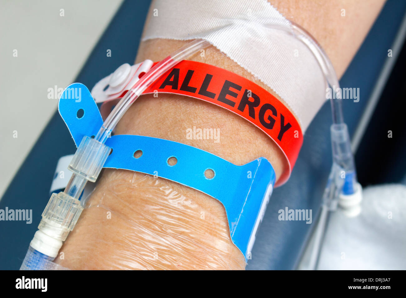 A hospital patient with an allergy bracelet and IV needle in her hand ...