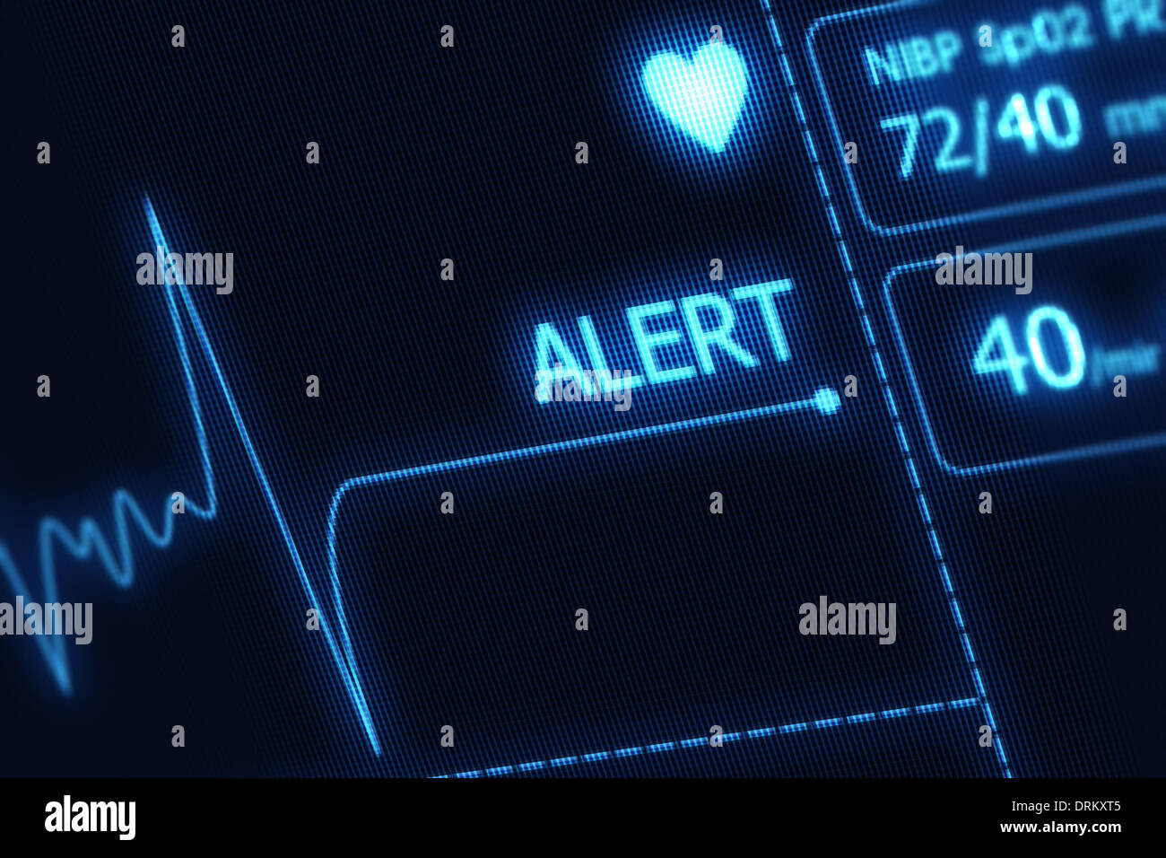 Ekg alert illustration no pulse hi-res stock photography and images - Alamy