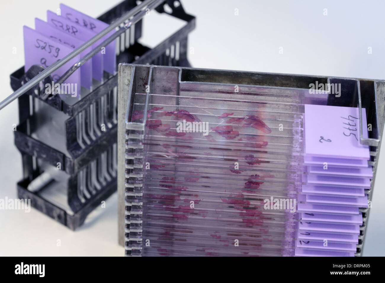 glass slides with histology samples in a histology labor Stock Photo ...