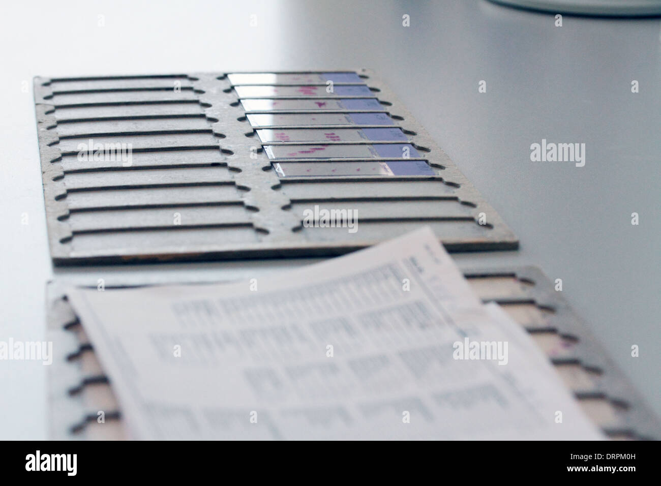glass slides with histology samples in a histology labor Stock Photo ...