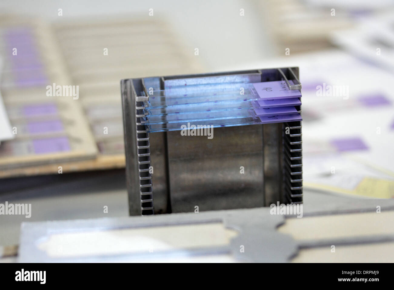 glass slides with rack in a histology labor Stock Photo - Alamy