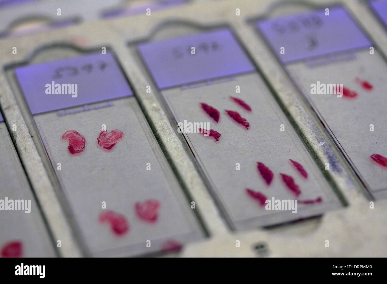 histology real samples object slides for light microscope Stock Photo ...