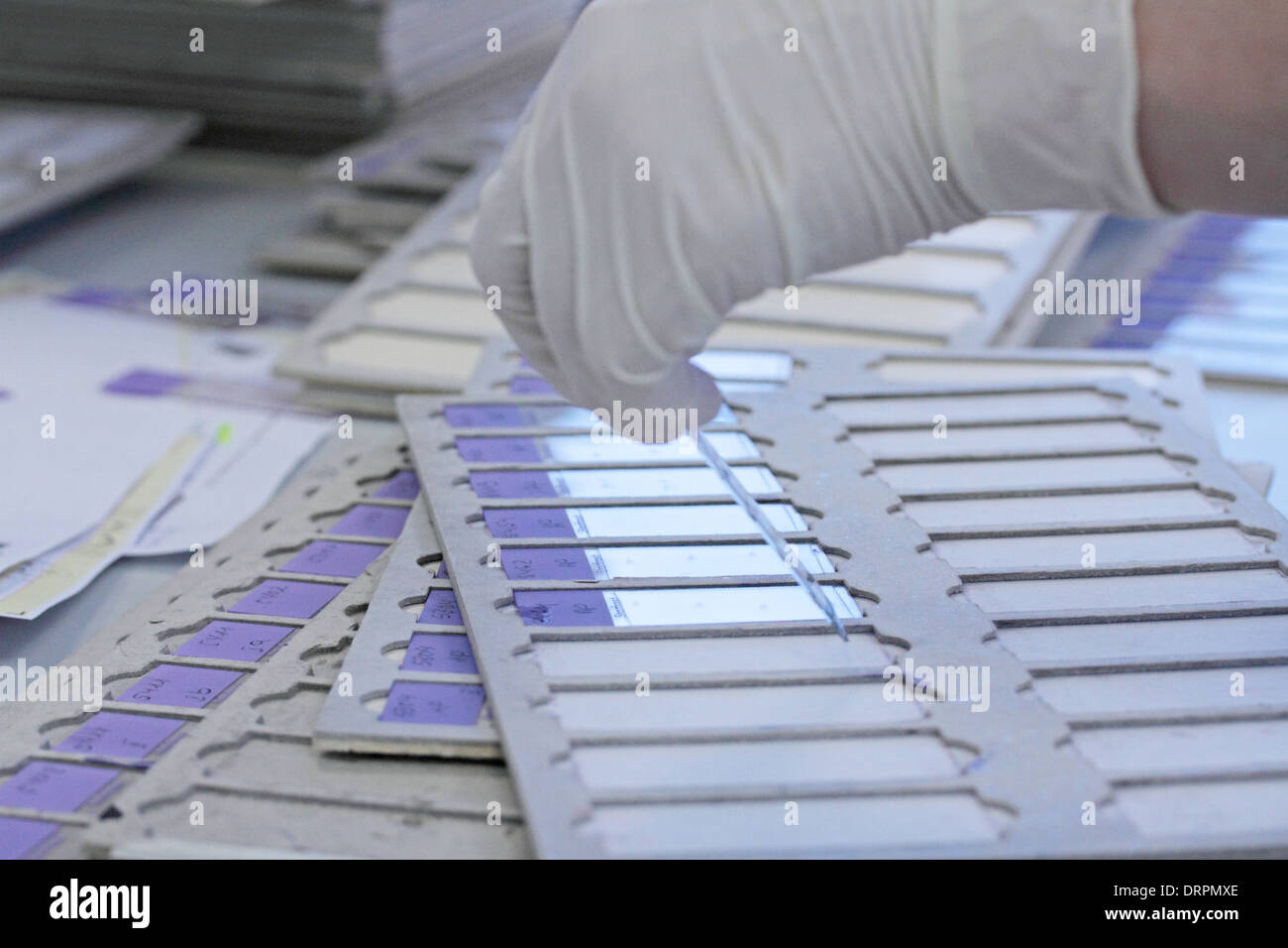 Microscope glass slides in histology hi-res stock photography and ...