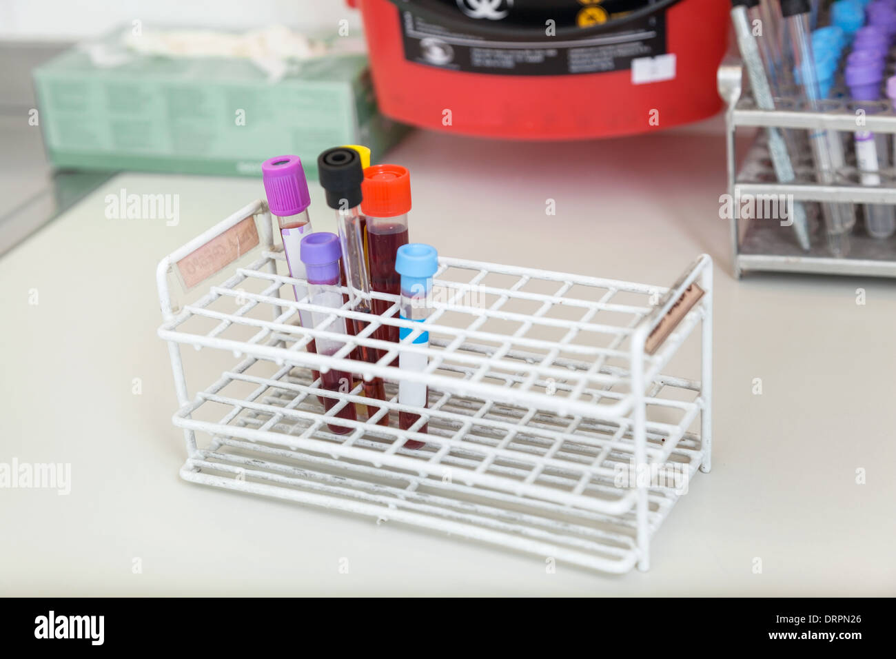 Test Tubes With Blood Samples Stock Photo - Alamy