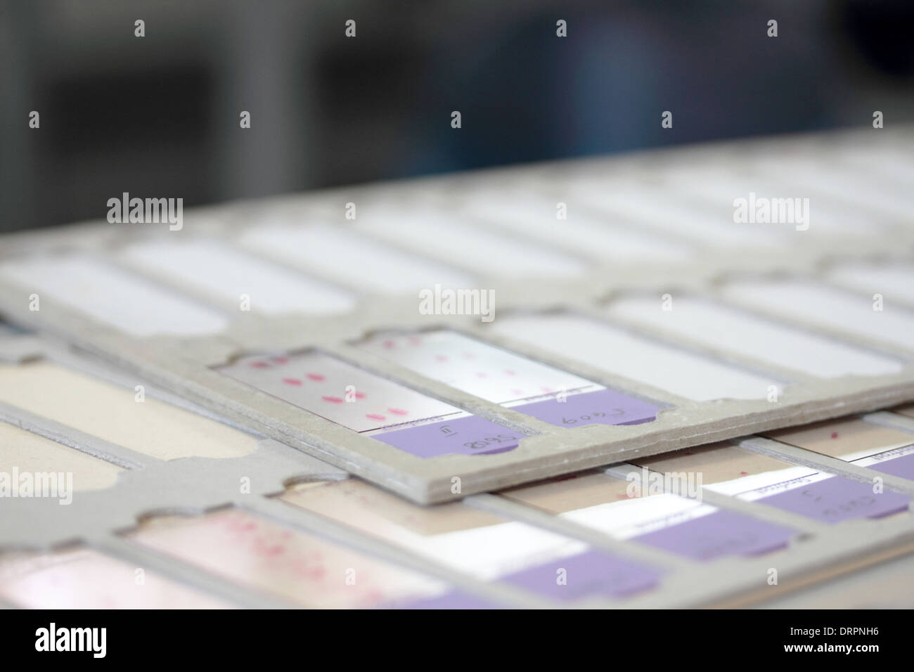 samples of glass slides in a histology or pathology labor Stock Photo ...