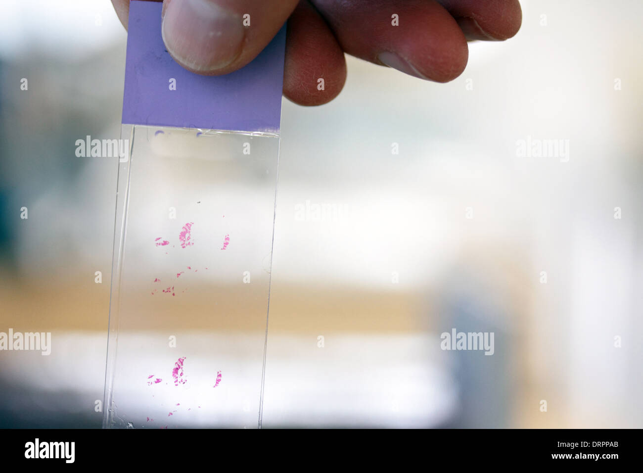 Pathology slide hi-res stock photography and images - Alamy