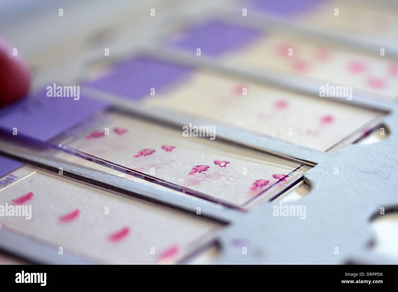 Pathology slide hi-res stock photography and images - Alamy