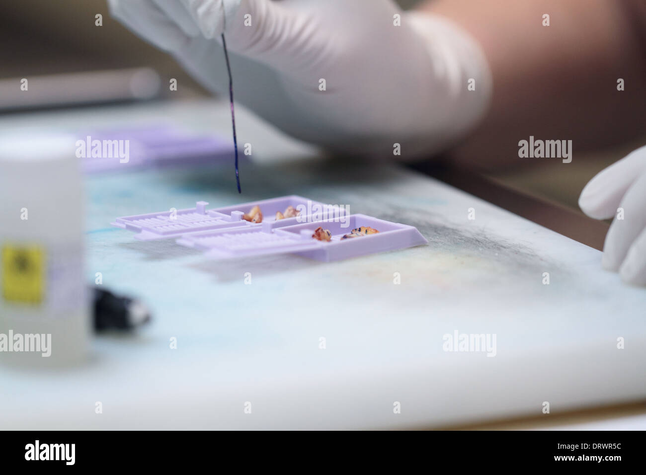 histology samples preparing in a pathology labor Stock Photo - Alamy