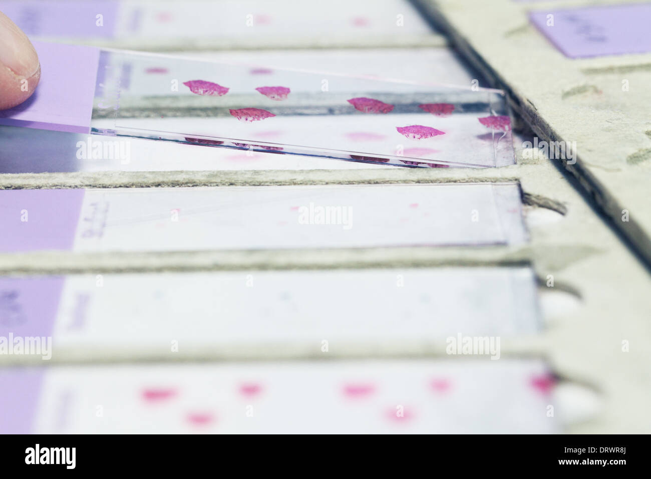 Microscope histology hi-res stock photography and images - Alamy