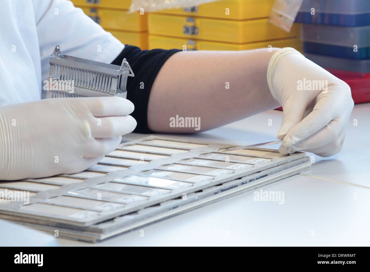 histology real samples object slides for light microscope Stock Photo ...