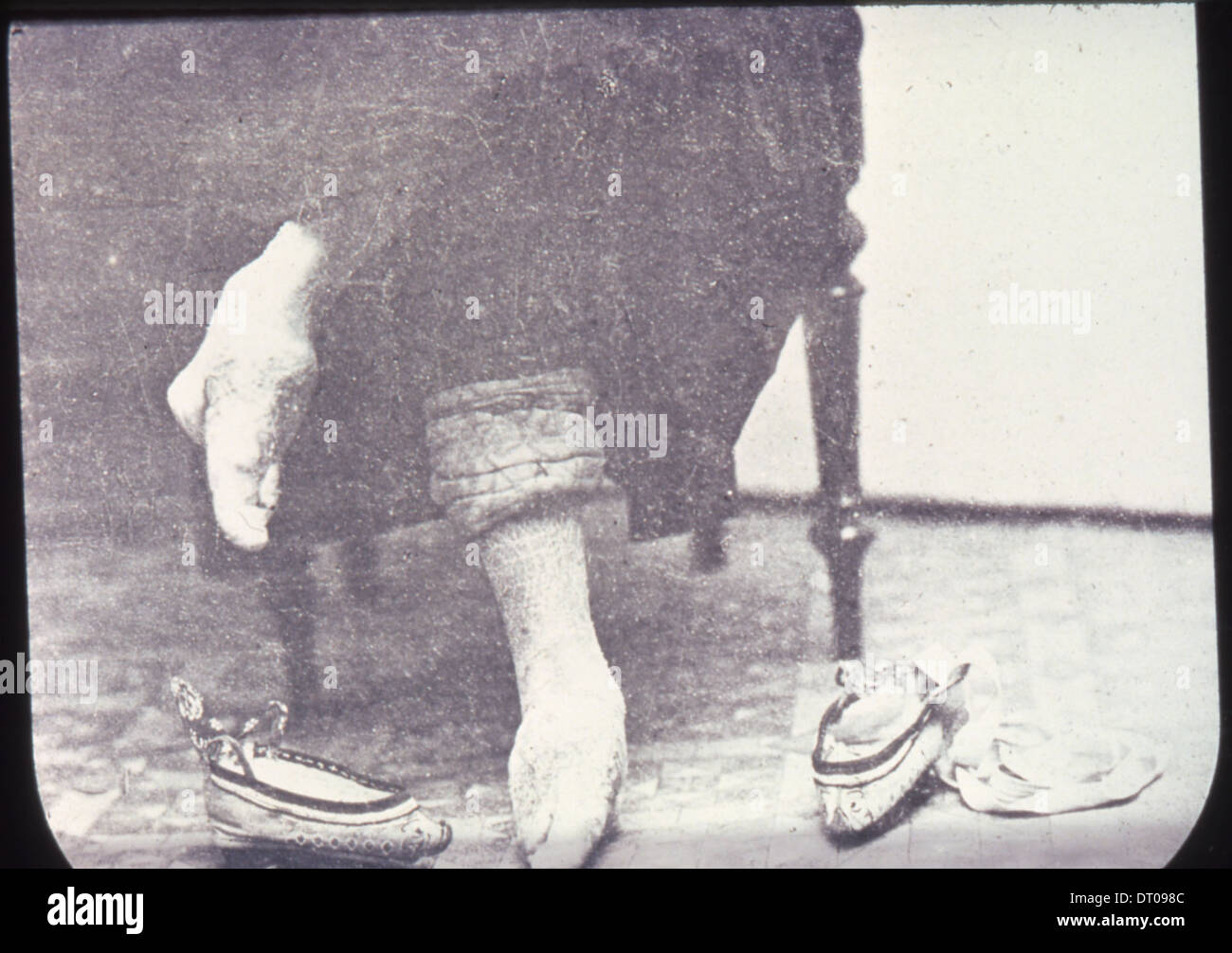 A photograph showing a Chinese woman with bound feet from Changde ...