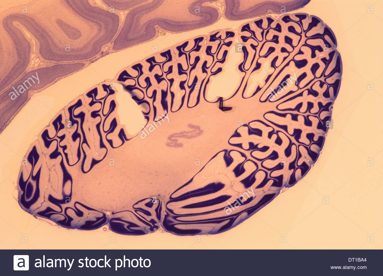 Tissue Specimen High Resolution Stock Photography and Images - Alamy