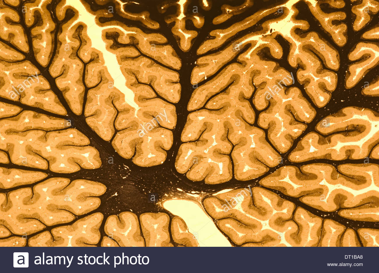 Brain Tissue Stock Photos & Brain Tissue Stock Images - Alamy