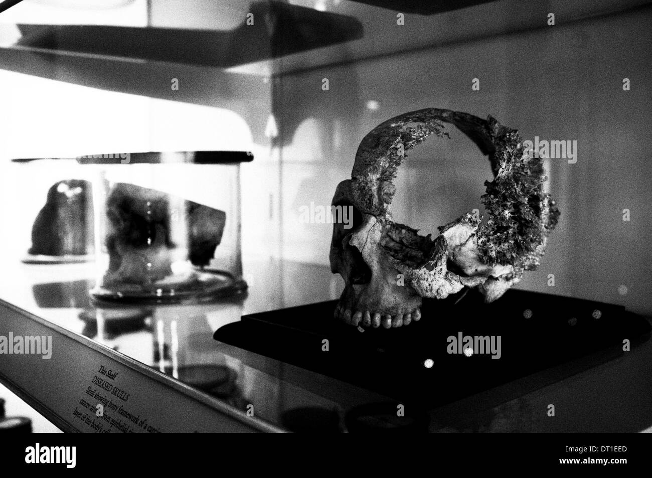 Medical skull specimen hi-res stock photography and images - Alamy