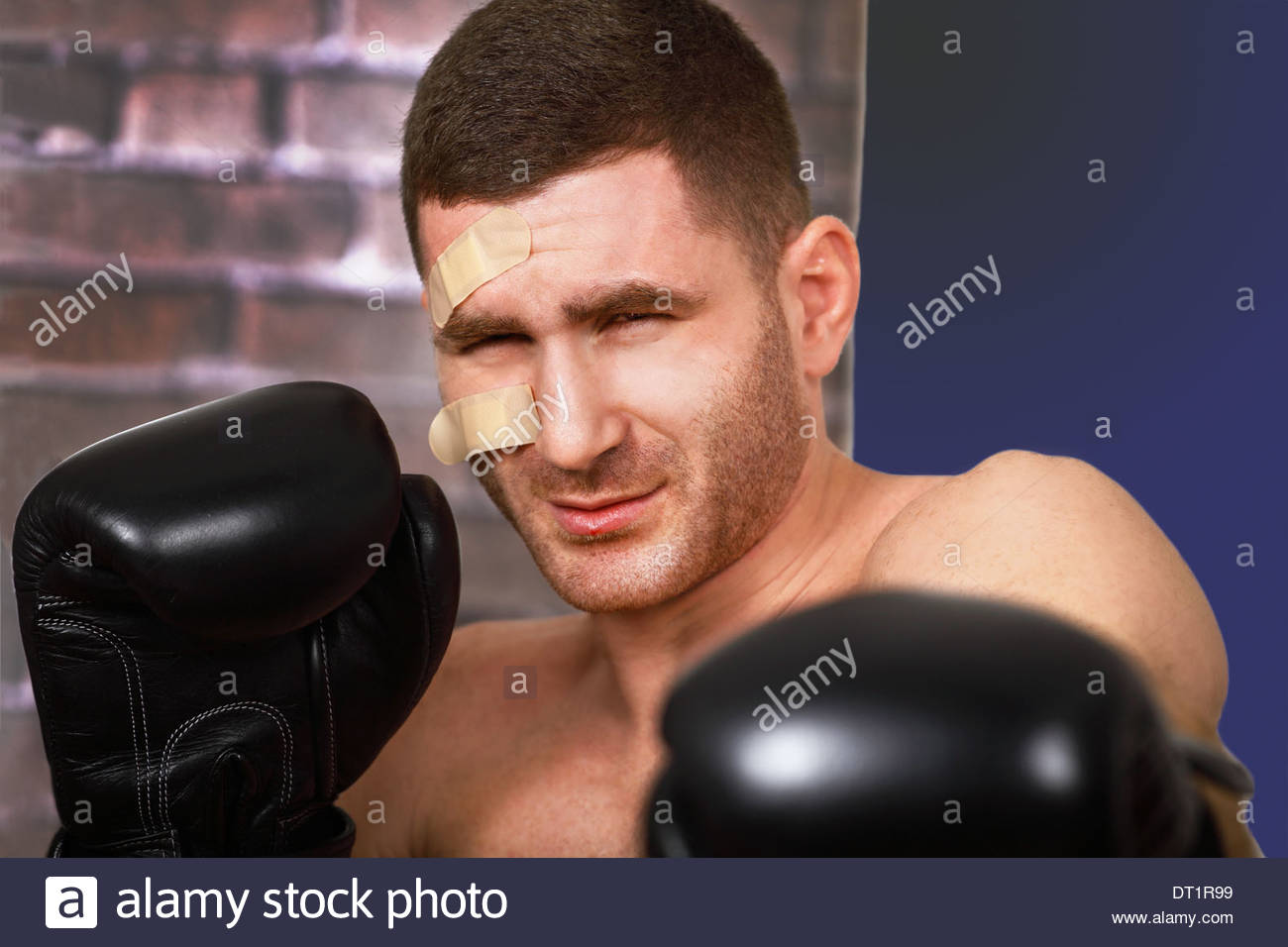 Split Lip High Resolution Stock Photography and Images - Alamy