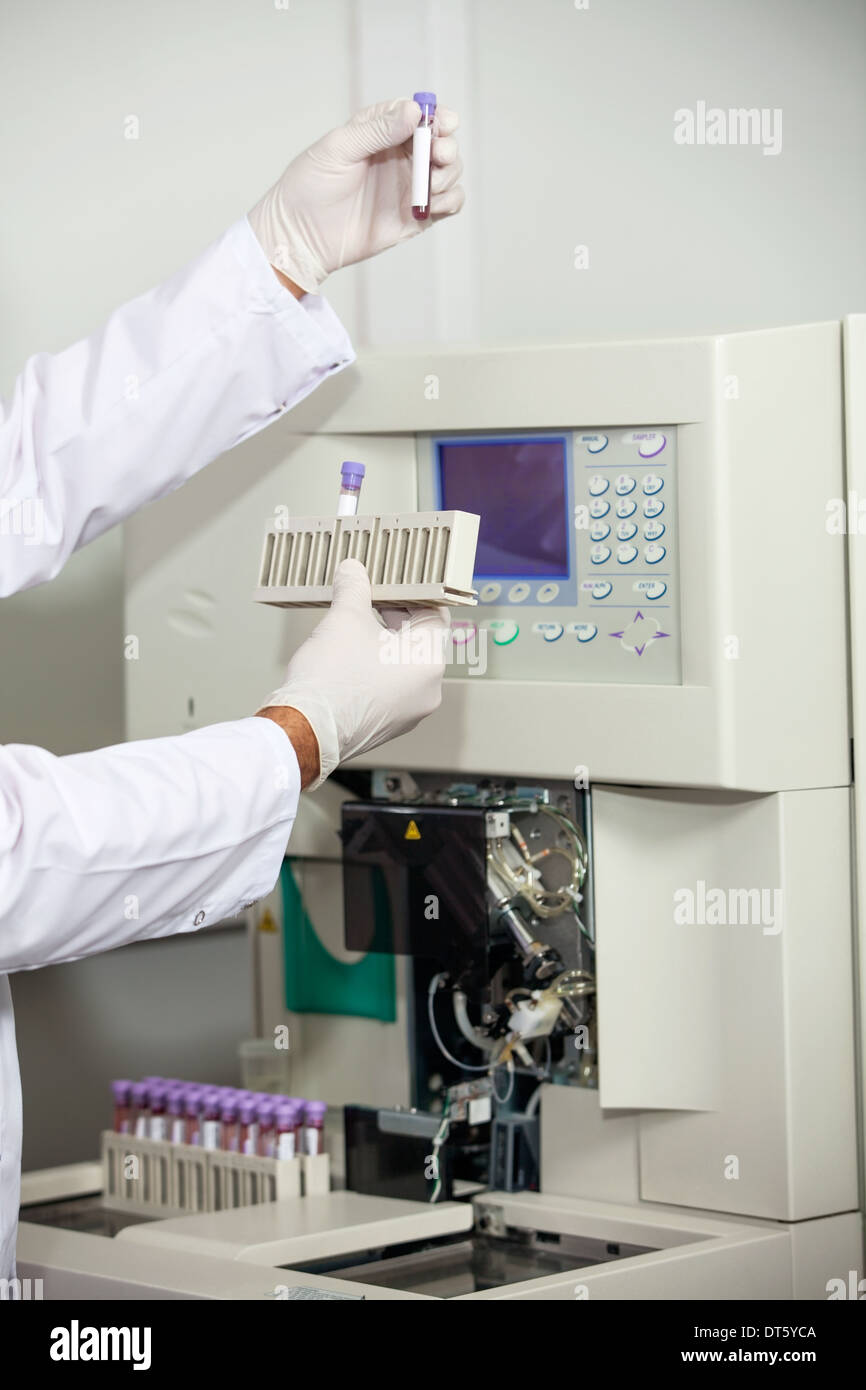 Blood chemistry analyzer hi-res stock photography and images - Alamy