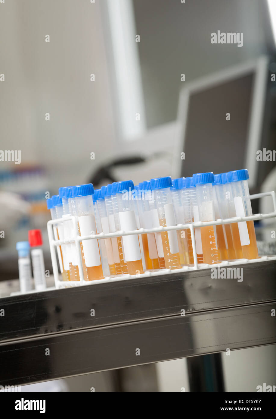 Test Tubes In Medical Laboratory Stock Photo - Alamy