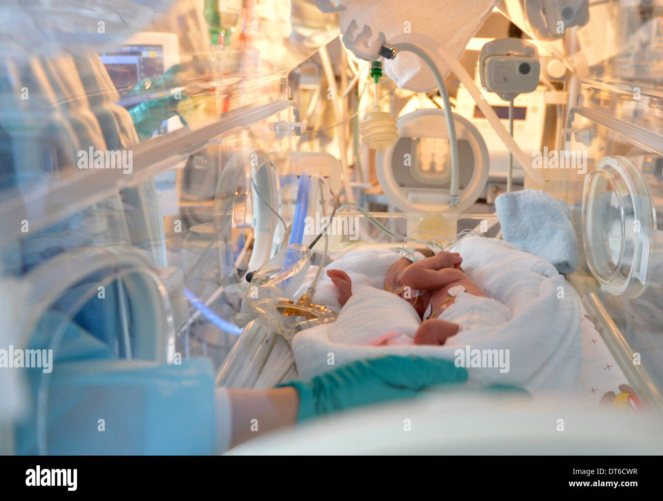 A premature newborn infant lies in an incubator at the neonatal ...